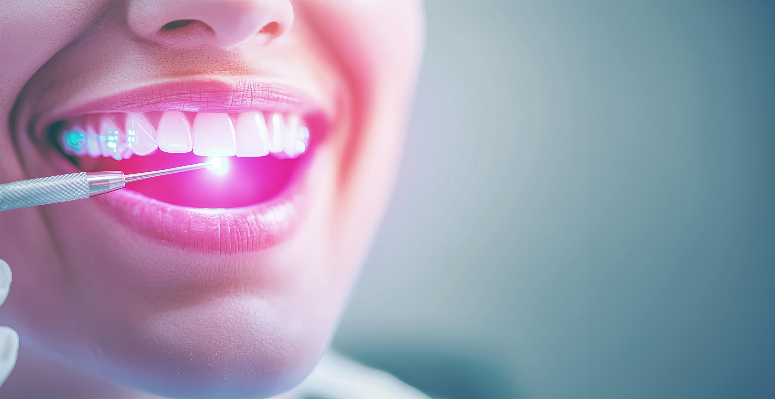 Laser Gum Treatment in Prosper, TX | LANAP Procedure Near Me